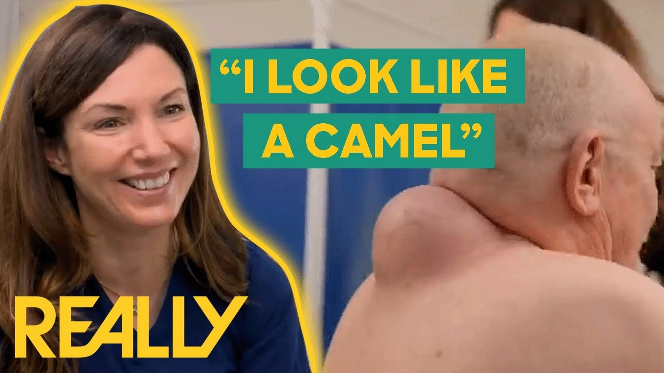 Dr Emma Helps Patient With A Cricket Ball Sized LUMP On The Back Of Dr Emma Helps Patient With A Cricket Ball Sized LUMP On The Back Of